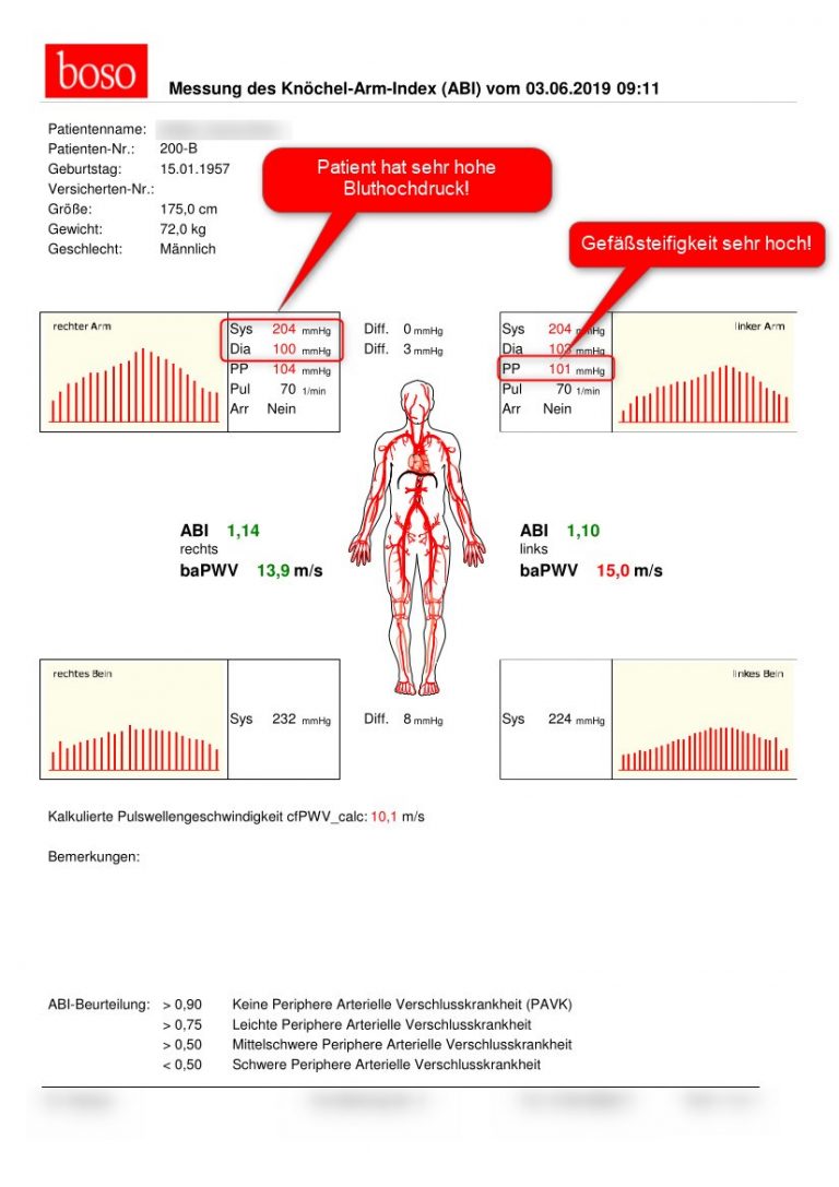 ABI-Messung - Die Gefäßgesundheit messen